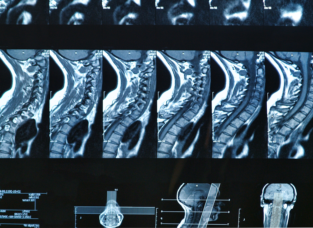 The MRI Diagnostic Test - N8 Family Chiropractic